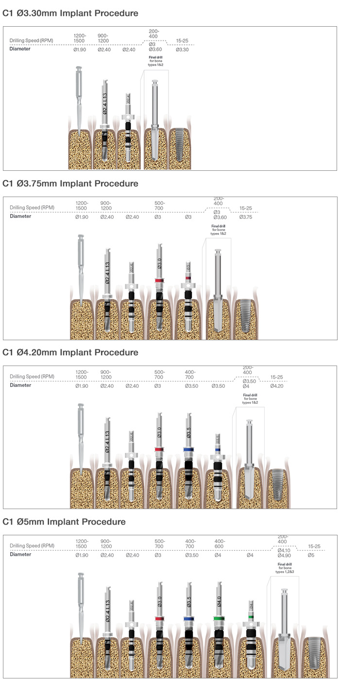 C1 - Conexão Cônica | MIS Implantes Brasil